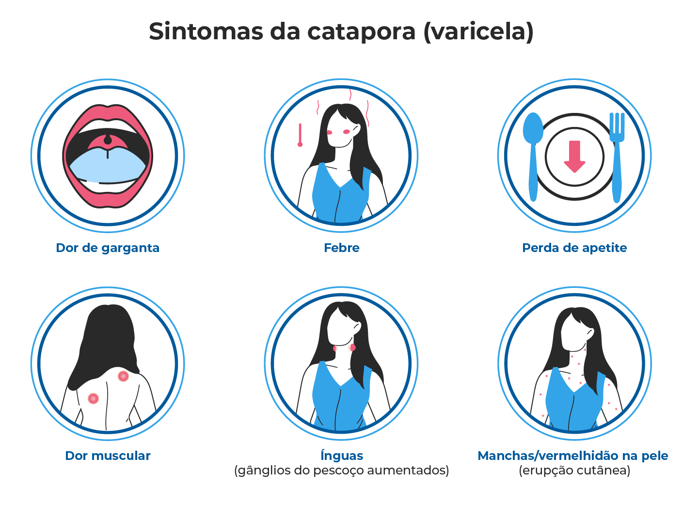 Catapora ou varicela: sintomas, tratamento e prevenção | Einstein