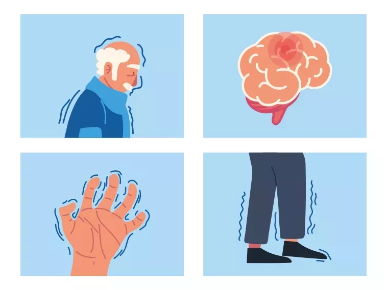 Parkinson's Disease: Symptoms, Causes, and Treatments