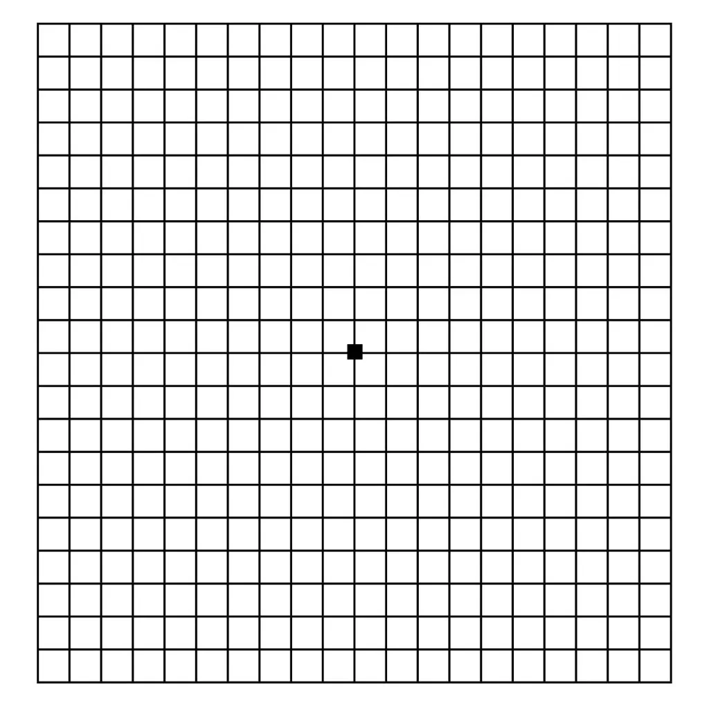 Degeneração Macular Relacionada à Idade (DMRI): Sintomas, Causas e ...
