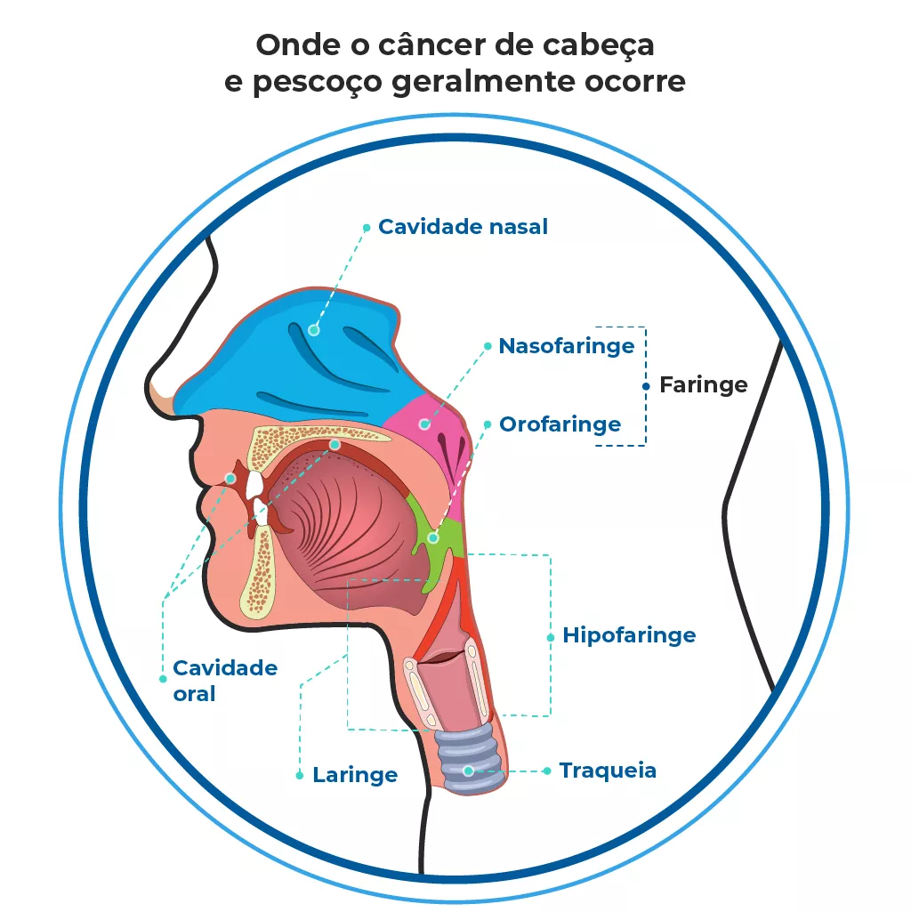 Câncer de cabeça e pescoço: Sintomas, Causas e Tratamentos