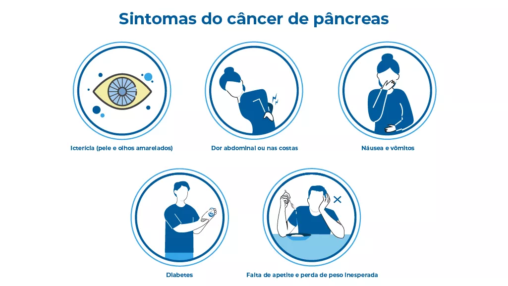 Câncer de pâncreas: Sintomas, Causas e Tratamentos