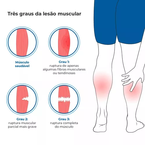 Lesão muscular: Sintomas, Causas e Tratamentos